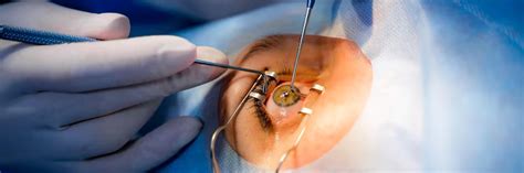 Diabetes And Visual Outcomes After Epiretinal Membrane Surgery