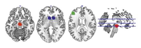Map Demonstrating The Selected Mesocorticolimbic Structures In The Download Scientific Diagram