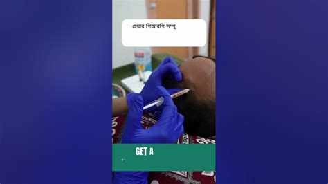 চুল পড়ার সমস্যা সমাধানে Prp একটি কার্যকর চিকিৎসাপদ্ধতি । Youtube