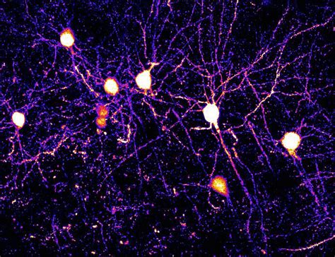 Distinct Synaptic Plasticity Rules Operate Across Dendritic Compartments Neural Therapies
