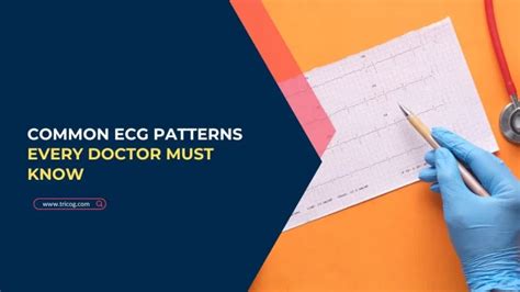 ecg patterns critical diagnostic skills for doctors
