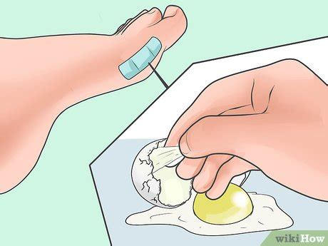 How To Painlessly Remove A Splinter 11 Steps With Pictures