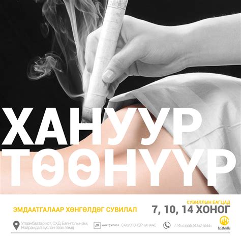 Nomun Wellness Resort Төөнүүр Эл эмчилгээний зарчим нь өвчлөлтэй эрхтний мэдрэлийн эх