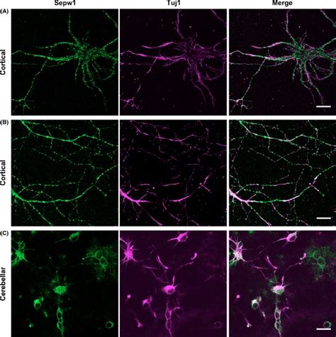 Selenoprotein W Sepw1 Is Expressed In Cell Bodies And Processes Of