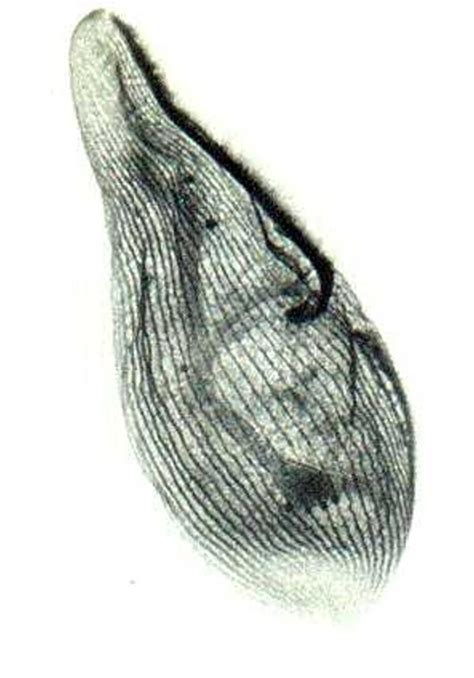 Blepharisma 100x