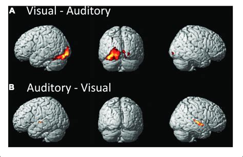 The Figures Display The Differential Effects Between The Visual And