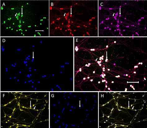 Triple Immunolabeling Of Luhmes Cells For Tyrosine Hydroxylase Th