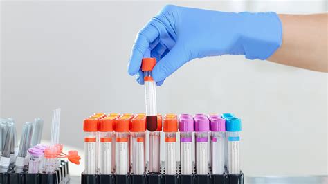 Assay Verification And Validation — Bio Rad