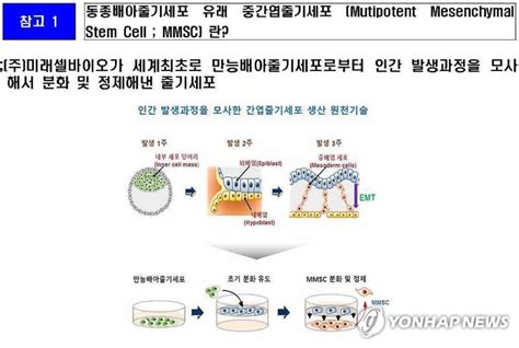 박세필 교수팀 난치성 두드러기 질환 줄기세포로 치료 파이낸셜뉴스