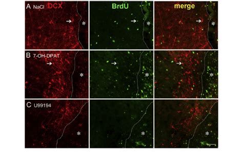 Photomicrographs Of The Lateral Border Of The Lesion In The Three