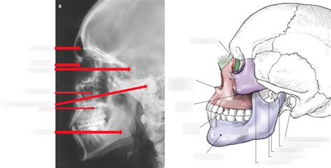 Lateral Facial Bones X Ray And Figure Diagram Quizlet