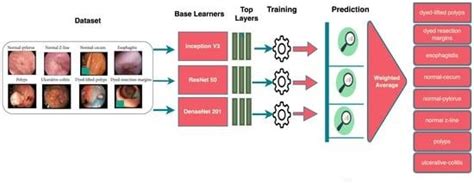 Git Net An Ensemble Deep Learning Based Gi Tract Classification Of