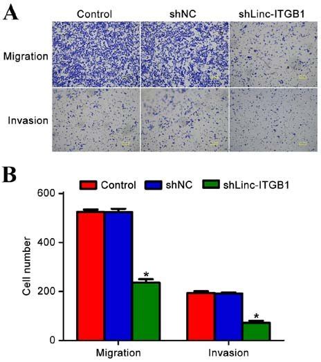 Knockdown Of Linc Itgb1 Inhibits Cell Migration And Invasion In Hcclm3