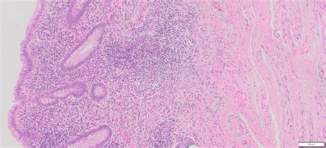 Human Appendix Normal Ffpe Sections