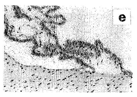 7 In Situ Hybridization Followed By Autoradiography Of Choroid Plexus Download Scientific