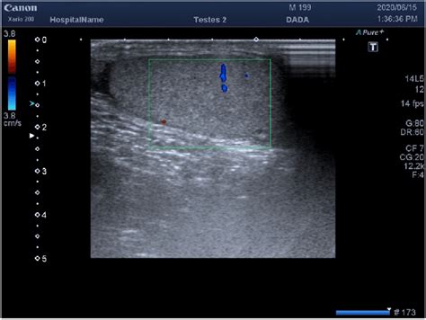 Color Doppler Image Shows Blood Flow And Echotexture Of The Download Scientific Diagram