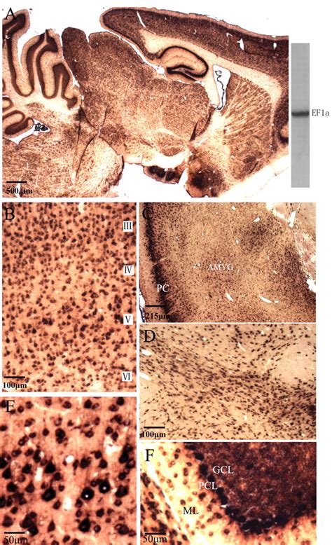 Figure 1 The Mrna For Elongation Factor 1α Is Localized In Dendrites