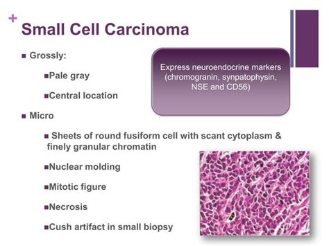 Lung Cancer Pathology And Clinical Pptx