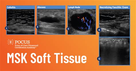 Point Of Care 🔎 Use Soft Tissue Ultrasound To Quickly Differentiate