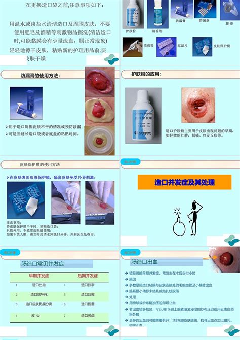 Ppt