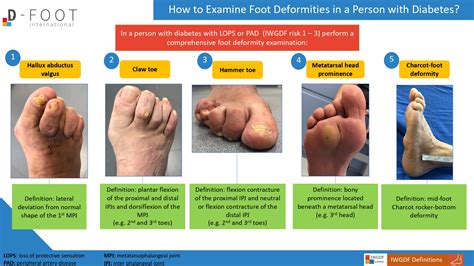 Wiedza Praktyczna W Zakresie Leczenia Ran
