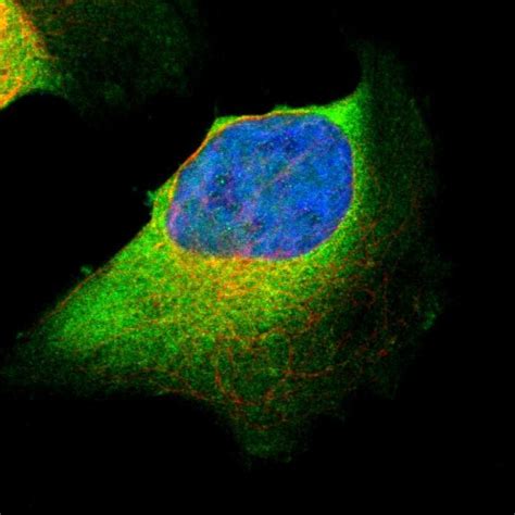 Rabbit Polyclonal Anti Cars Antibody Buy For Research Highly Specific Rigorously Validated