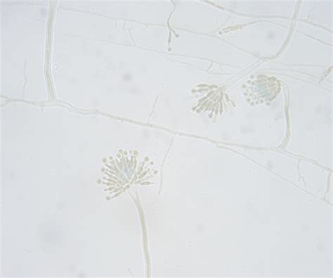 Aspergillus Nidulans Microscopic View Of Aspergillus Nidul Flickr