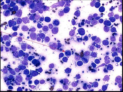 Cytology Round Cell Tumors I Flashcards Quizlet