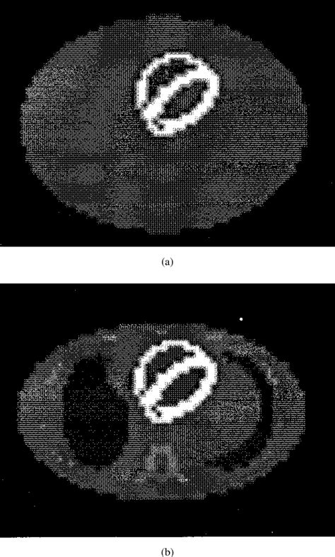 Figure 1 From Toward Accurate Attenuation Correction In Spect Without