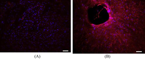The Staining Of Fibronectin Was Obviously Enhanced On Porous Download Scientific Diagram