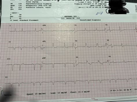 Incomplete Rbbb With Lad Rekgs