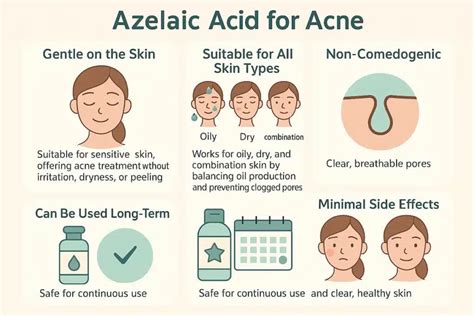 Why Choose Azelaic Acid Cream Or Gel For Acne Pimple In Uk