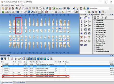 Dentrix Clinical Notes Templates