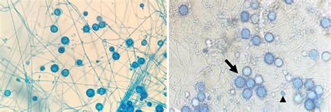 Histoplasma Capsulatum Scheda Micologica E Approfondimenti