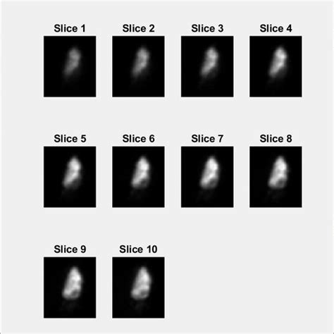 Matlab Plot Cnn Architecture Download Scientific Diagram
