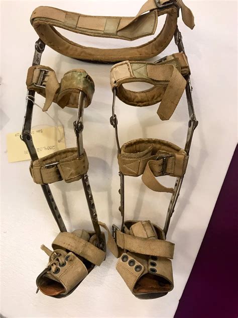 Leg Braces In Polio At Scott Sommer Blog
