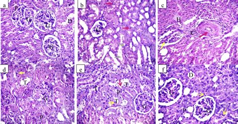 A Photomicrograph Of A Section In The Renal Cortex Of Adult Male Albino