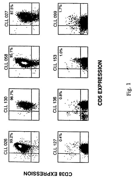 Cd38 As A Prognostic Indicator In B Cell Chronic Lymphocytic Leukemia