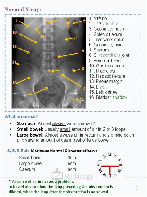 Gastrointestinal Tract Block Radiology Of The Abdomen Lecture