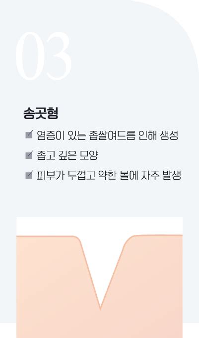 여드름 위클리닉