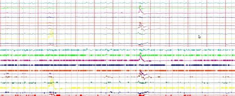 Int Java Reading 2 Byte Integer In 2s Complement From Binary File Into Integer Stack Overflow