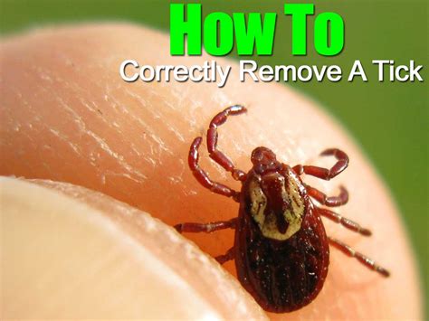 How To Remove A Tick