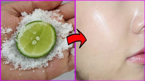 মাত্র এই দুটি উপাদান দিয়ে শরীরের কালো ছোপ মোছতা সহ যাবতীয় দাগ দূর করার উপায় দেখুন ভিডিও সহ