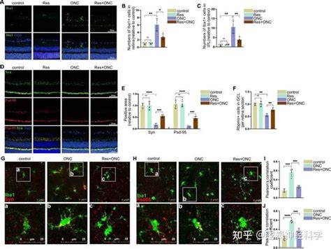Jni︱华中科技大学赵寅李星团队揭示视网膜神经节细胞损伤早期的保护策略及分子机制 知乎