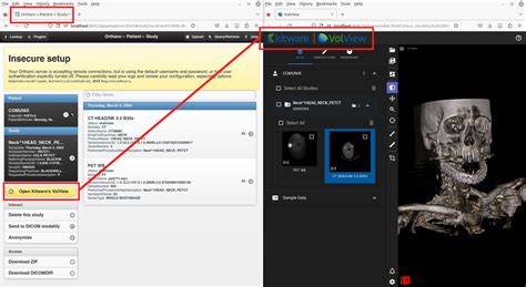 Kitwares VolView Plugin Orthanc Book Documentation