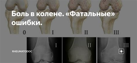Боль в колене «Фатальные ошибки Rheumatodoc Дзен