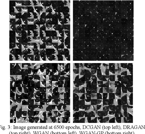 Figure 3 From Classification Of Lung Nodule Ct Images Using Gan