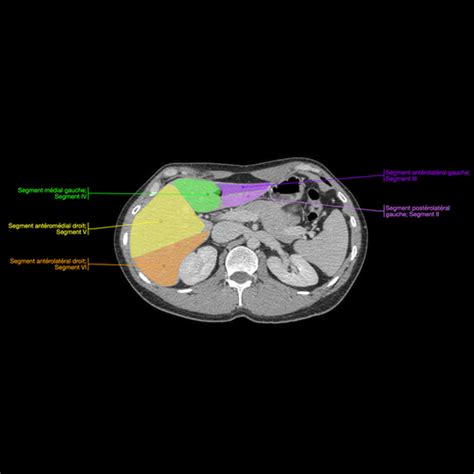 Object Segmentation The Reference Architectures In Medical Imaging