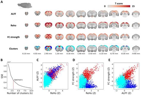 Voxel Level Resting State Fc Metrics A Group Level Significance Maps Download Scientific