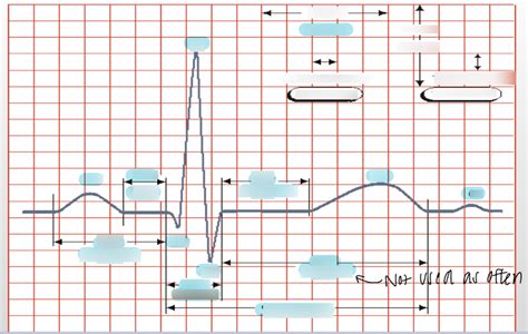 Block 4 Ecg 1 Diagram Ecg Wavesintervalssegments Diagram Quizlet
